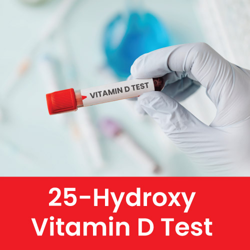 COVID-19 RT-PCR Screening, Walk in BP Healthcare, HomeVisit- Tested ...